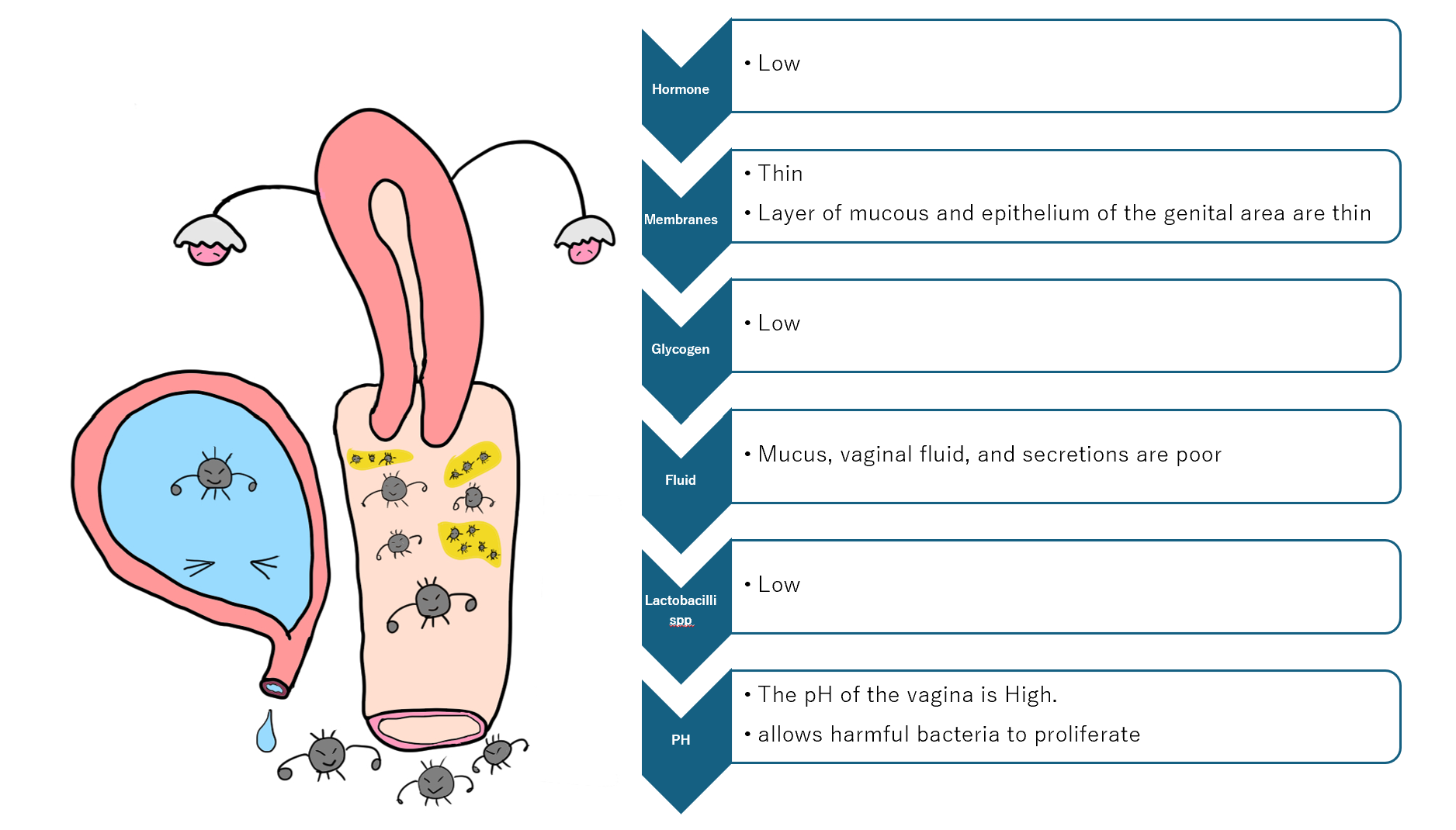 Recurrent Cystitis: The Overlooked Role of the Vaginal Microbiome – 日本橋 ...